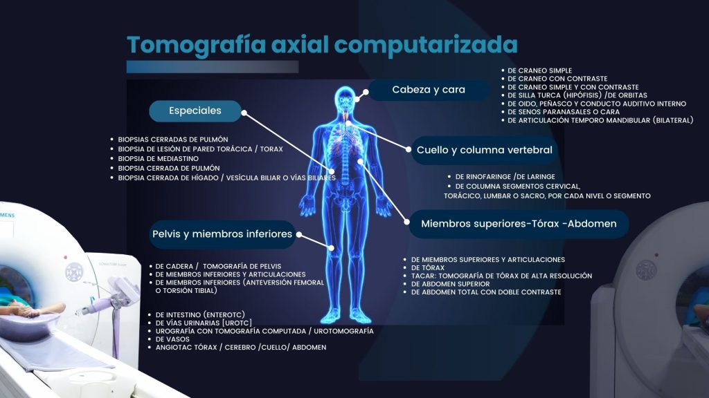 Tomografía Computarizada - Imágenes Diagnósticas del Llano