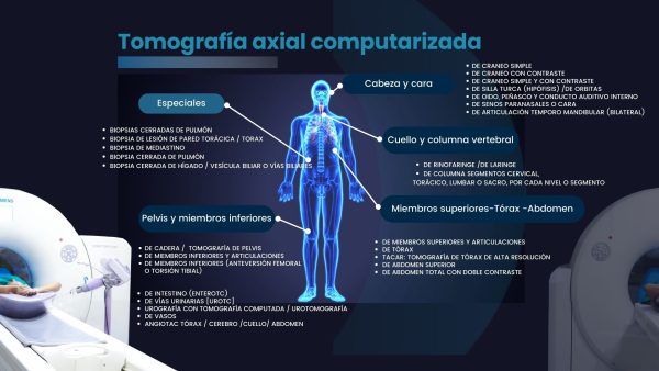 Tomografía Computarizada - Imágenes Diagnósticas del Llano